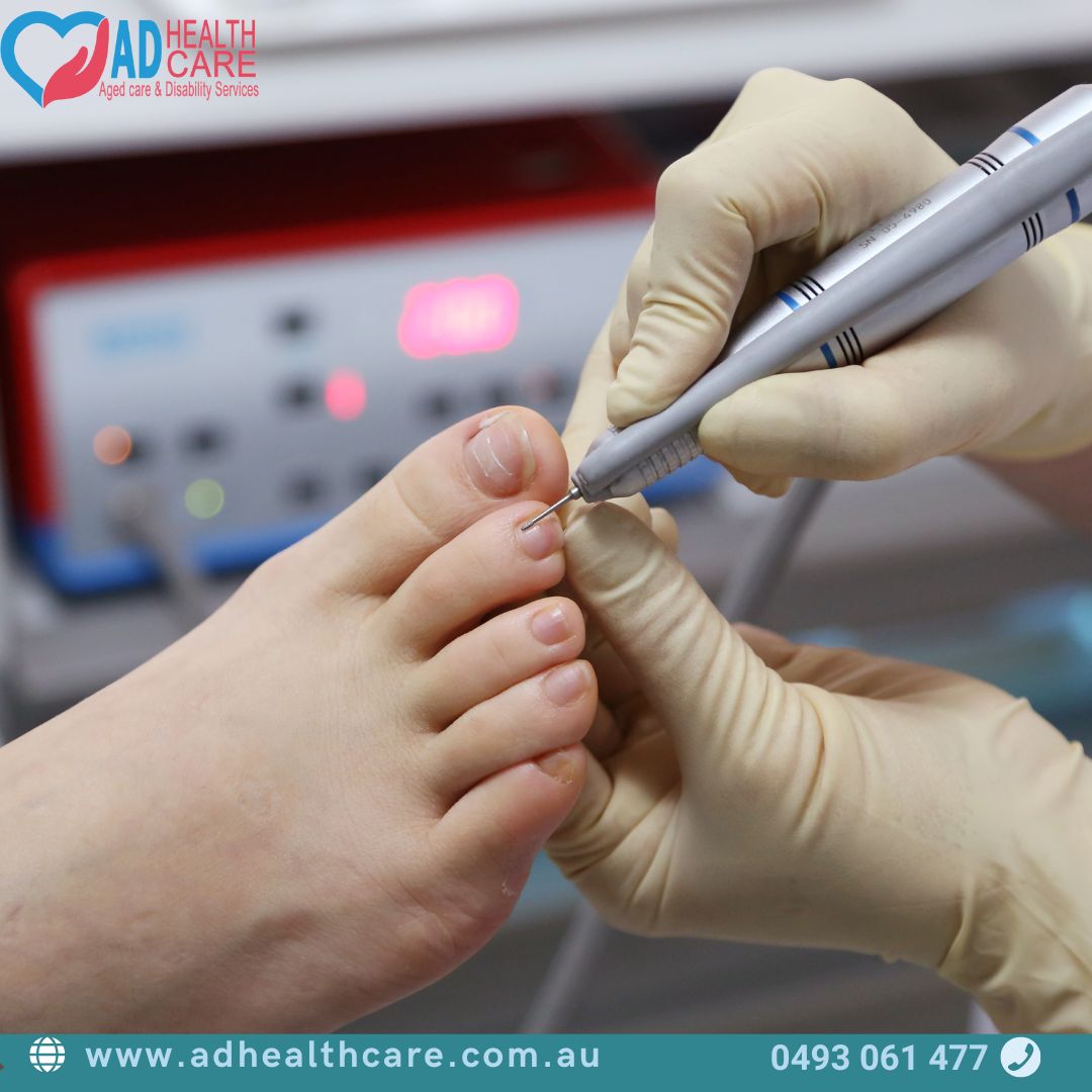 Podiatry NDIS Service Provider - 100% Trusted Services